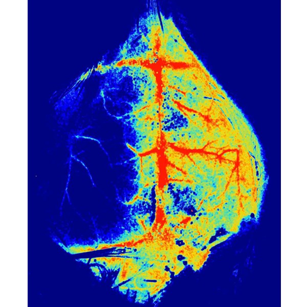 Laser Speckle Contrast Imaging RFLSI Ⅲ - Full-Field Blood Flow Imaging