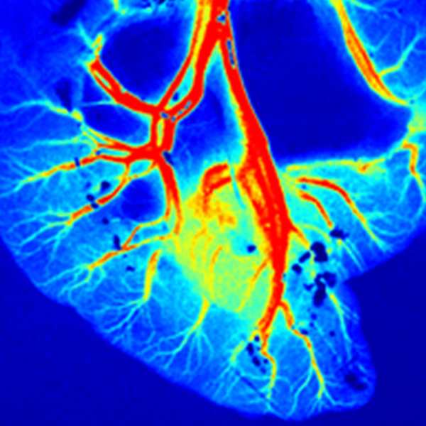 Laser Speckle Contrast Imaging RFLSI Ⅲ - Full-Field Blood Flow Imaging