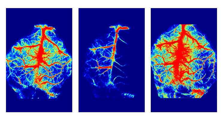 How to create a successful MCAO Stroke model？ - RWD Life Science