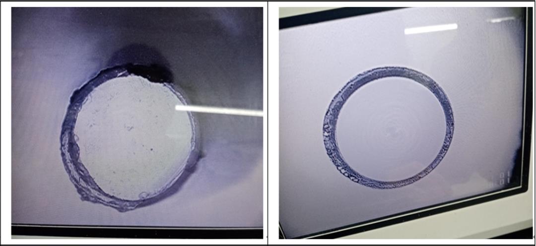 How to Choose A Fiber-Optic Cannula-RWD Life Science