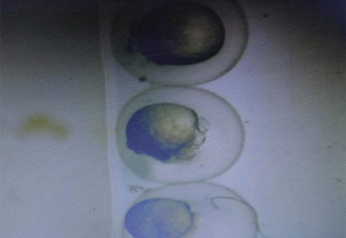 How To Perform Zebrafish Embryos Microinjection- RWD Science