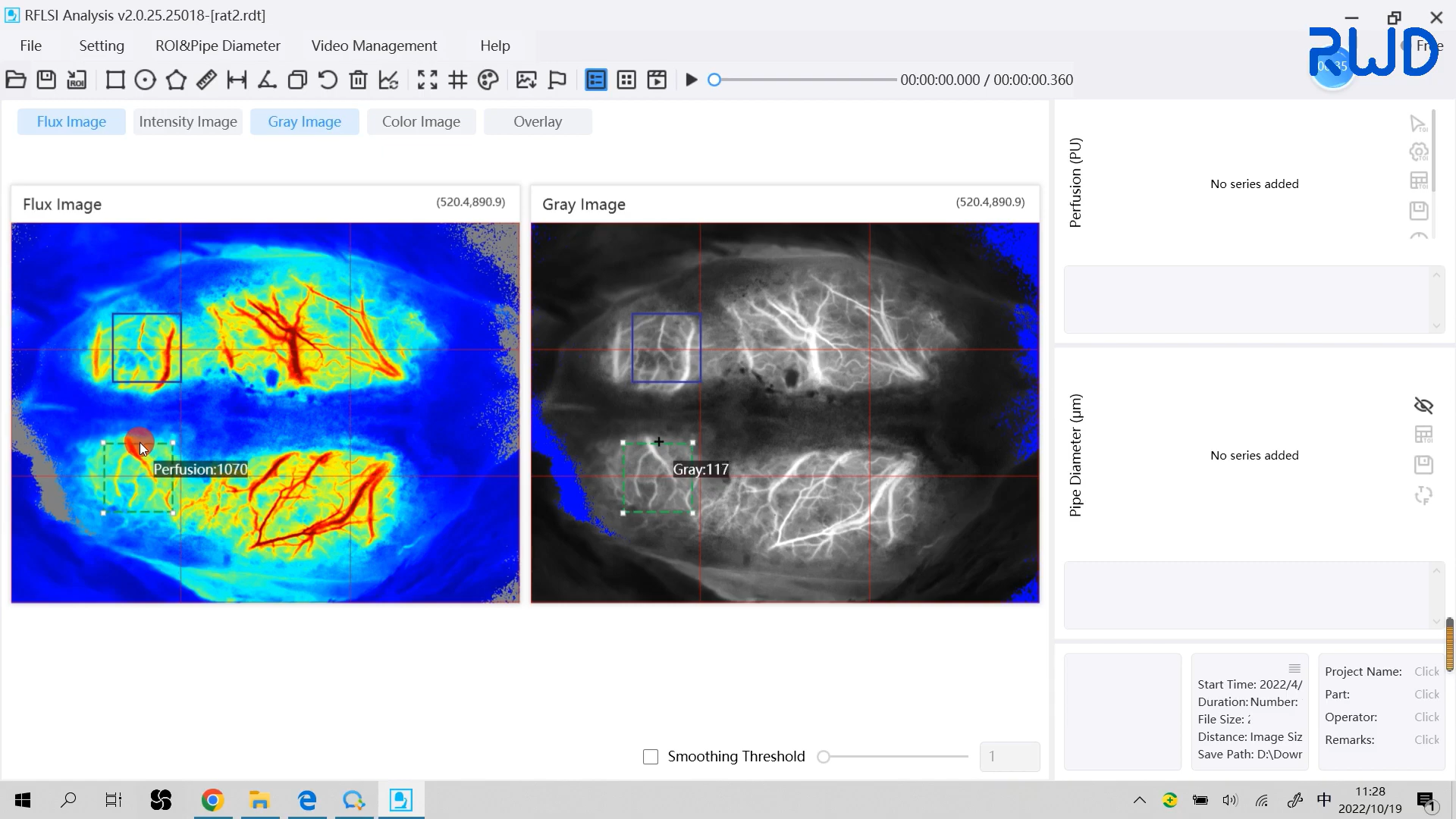 RWD RFLSI ZW Laser Speckle Imaging System-Analysis - RWD Life Science