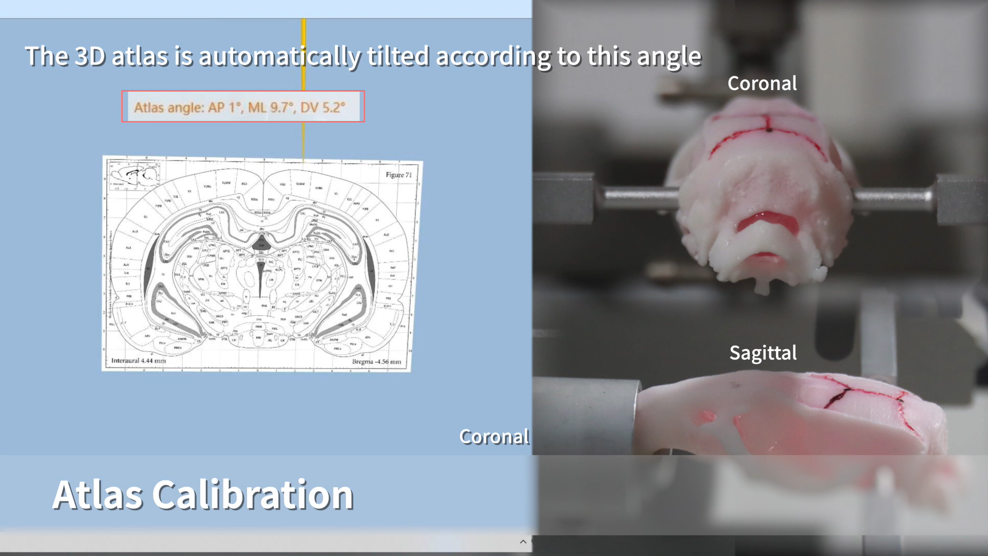 Automated Stereotaxic Instrument Operation-Accurate Position without ...