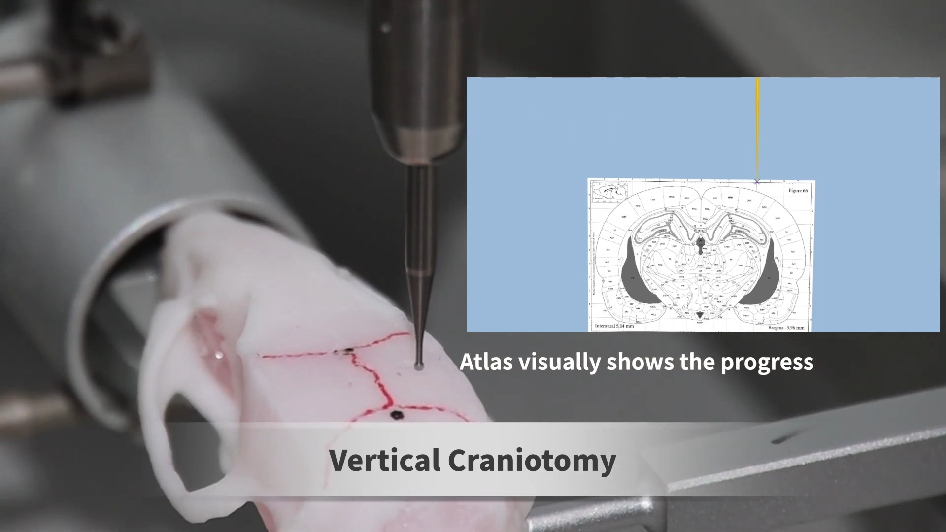 RWD Automated Stereotaxic Instrument Brain Injection - RWD Life Science