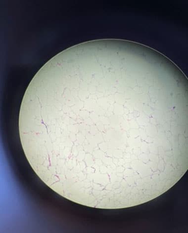 Seven Tips on Adipose Tissue Frozen Sectioning - RWD Life Science