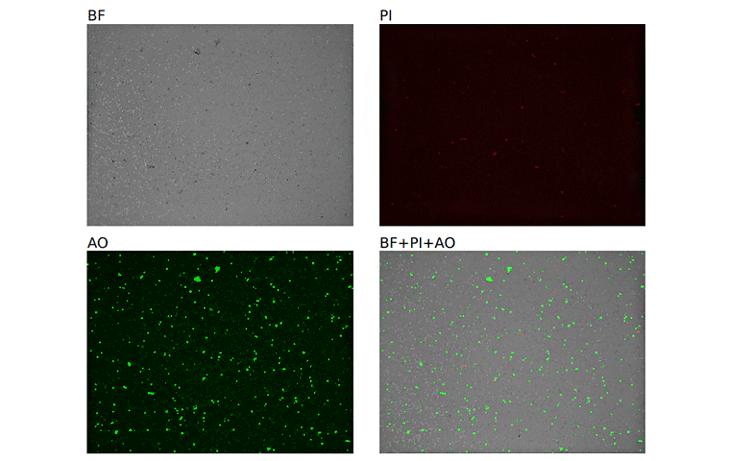 High Activity Tumor Tissue Enzymatic Digestion Kit(Human) - RWD Life ...