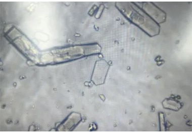 Application of RWD Paraffin Sectioning Machine in MSU-Induced Rat Gout ...