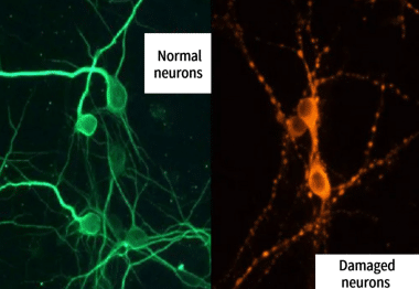 A Comprehensive Analysis of Primary Cortical and Hippocampal Neuron ...