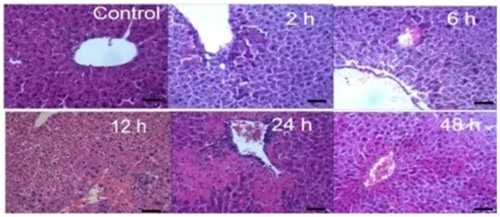 Application of the RWD Pathology Sectioning Machine in a CCl4-Induced ...