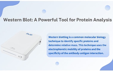 Western Blot: A Powerful Tool for Protein Analysis - RWD Life Science